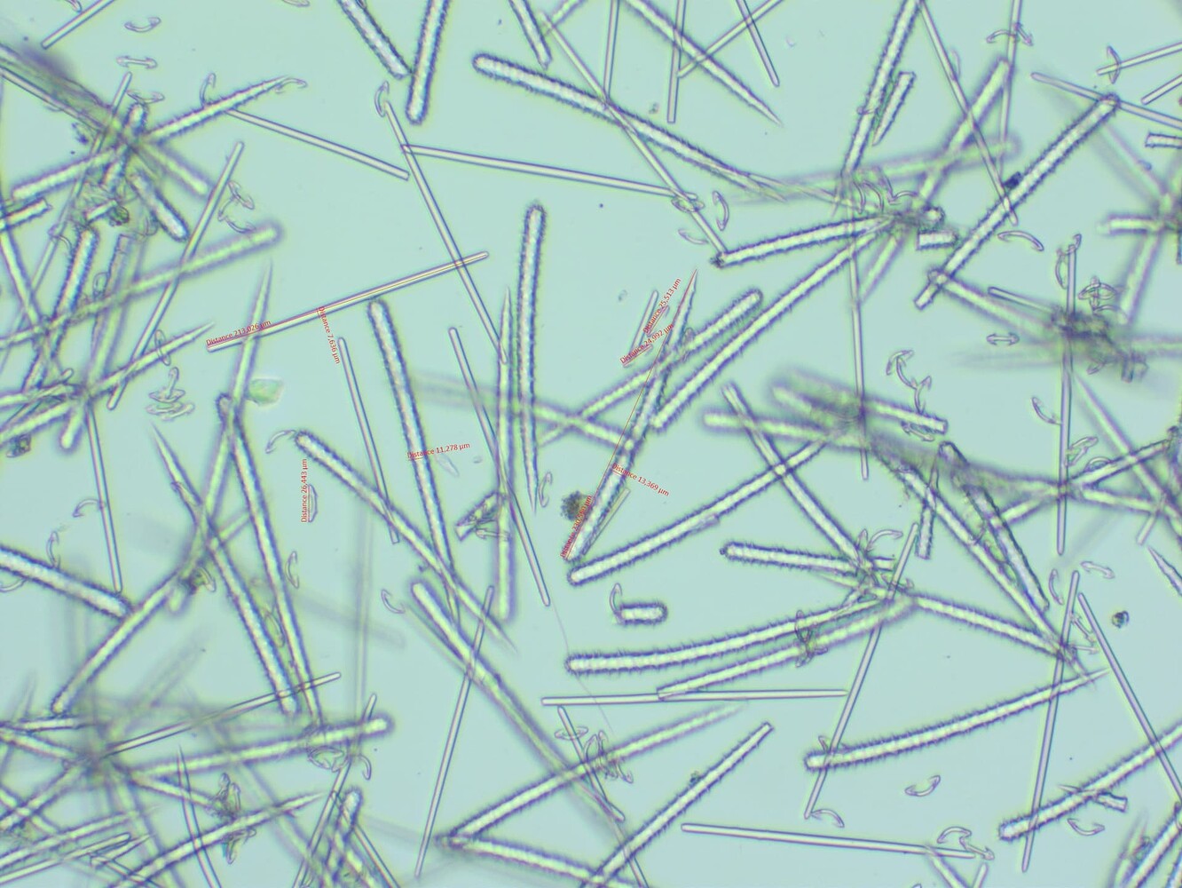 Spicule Treatments – Seoulogy